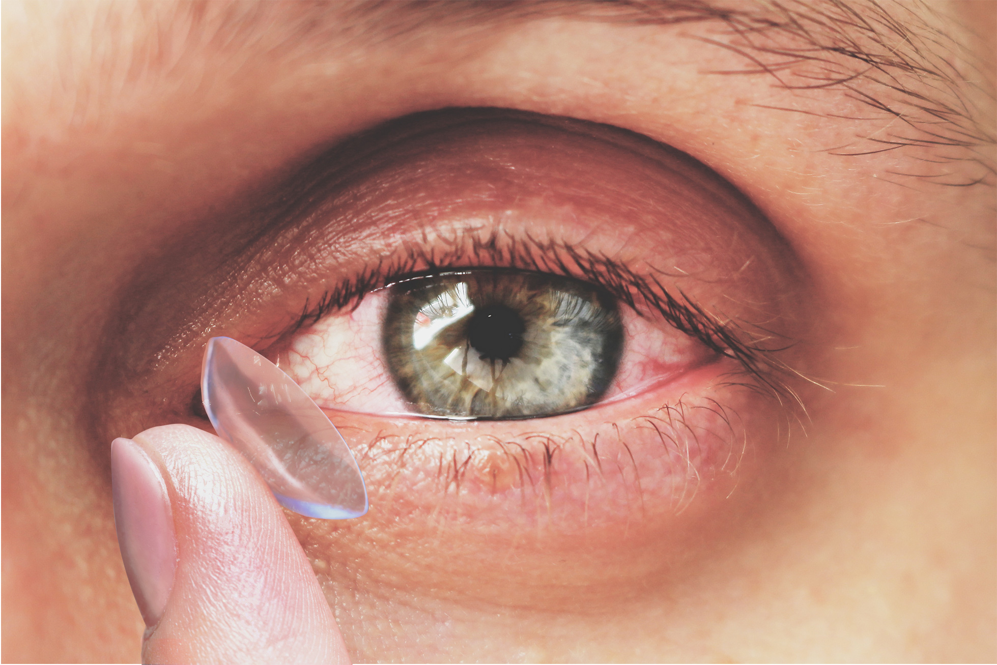 Alergiczne choroby oczu – rodzaje, objawy, leczenie ️Optegra